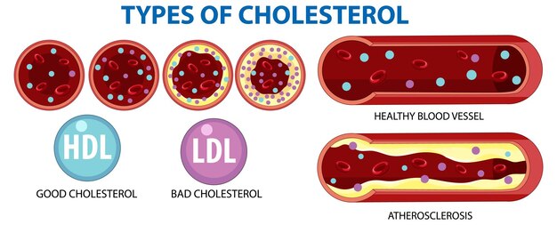 How to Lower Cholesterol Naturally Without Medication – 9jaPolyTv